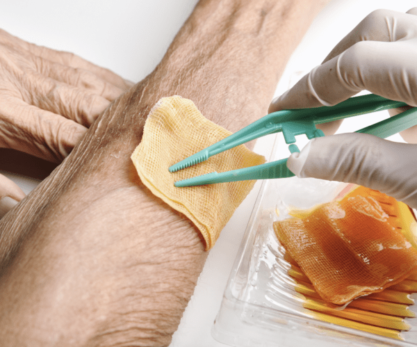 Wound Care Solutions for Healthcare Providers That Work